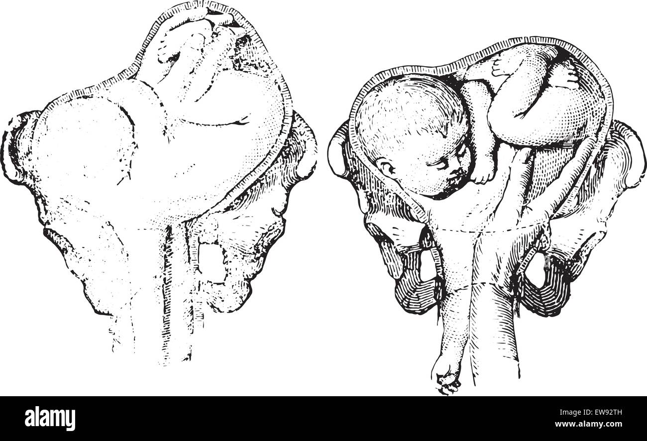 Womb baby drawing High Resolution Stock Photography and Images - Alamy