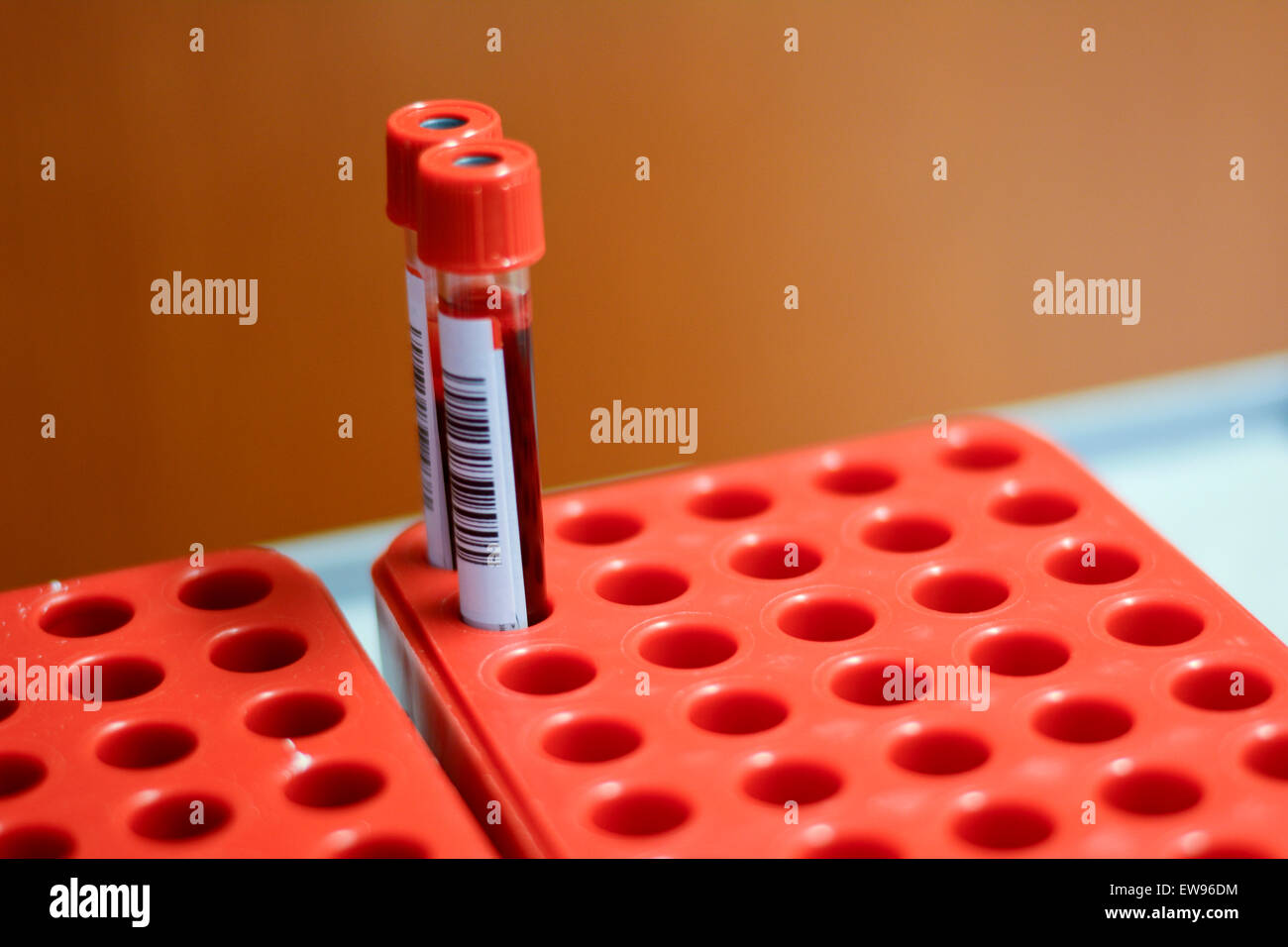 Berlin, Germany. 27th May, 2015. Blood samples are pictured in the ...
