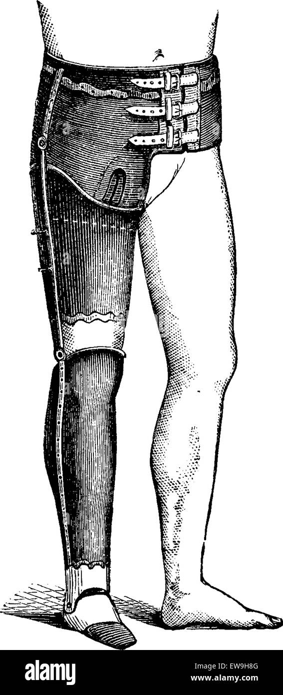 Prosthetic leg Black and White Stock Photos & Images - Alamy