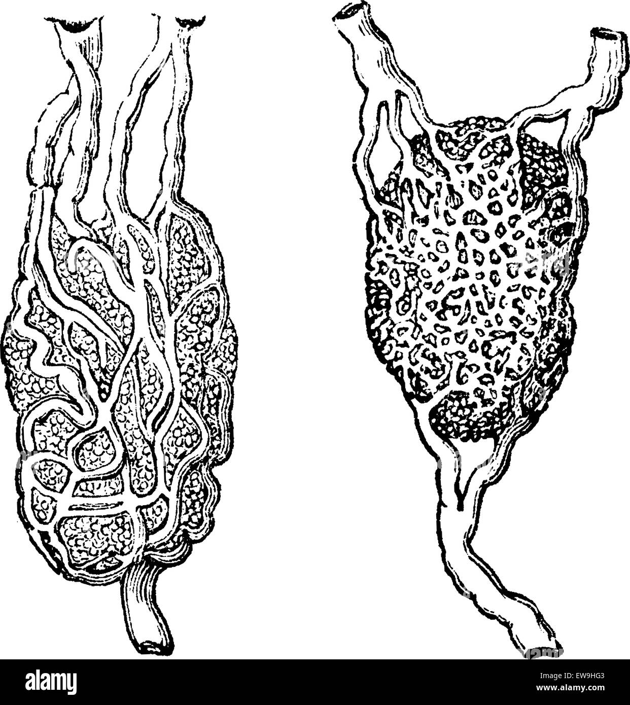 Lymph nodes, vintage engraved illustration. Usual Medicine Dictionary ...