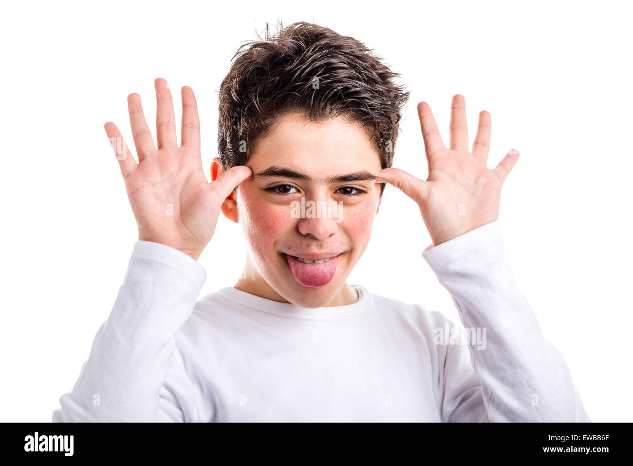 Funny Caucasian boy with acne-prone skin in a white long sleeved t ...