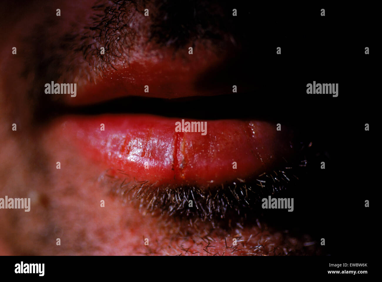 Cracked lips male hi-res stock photography and images - Alamy