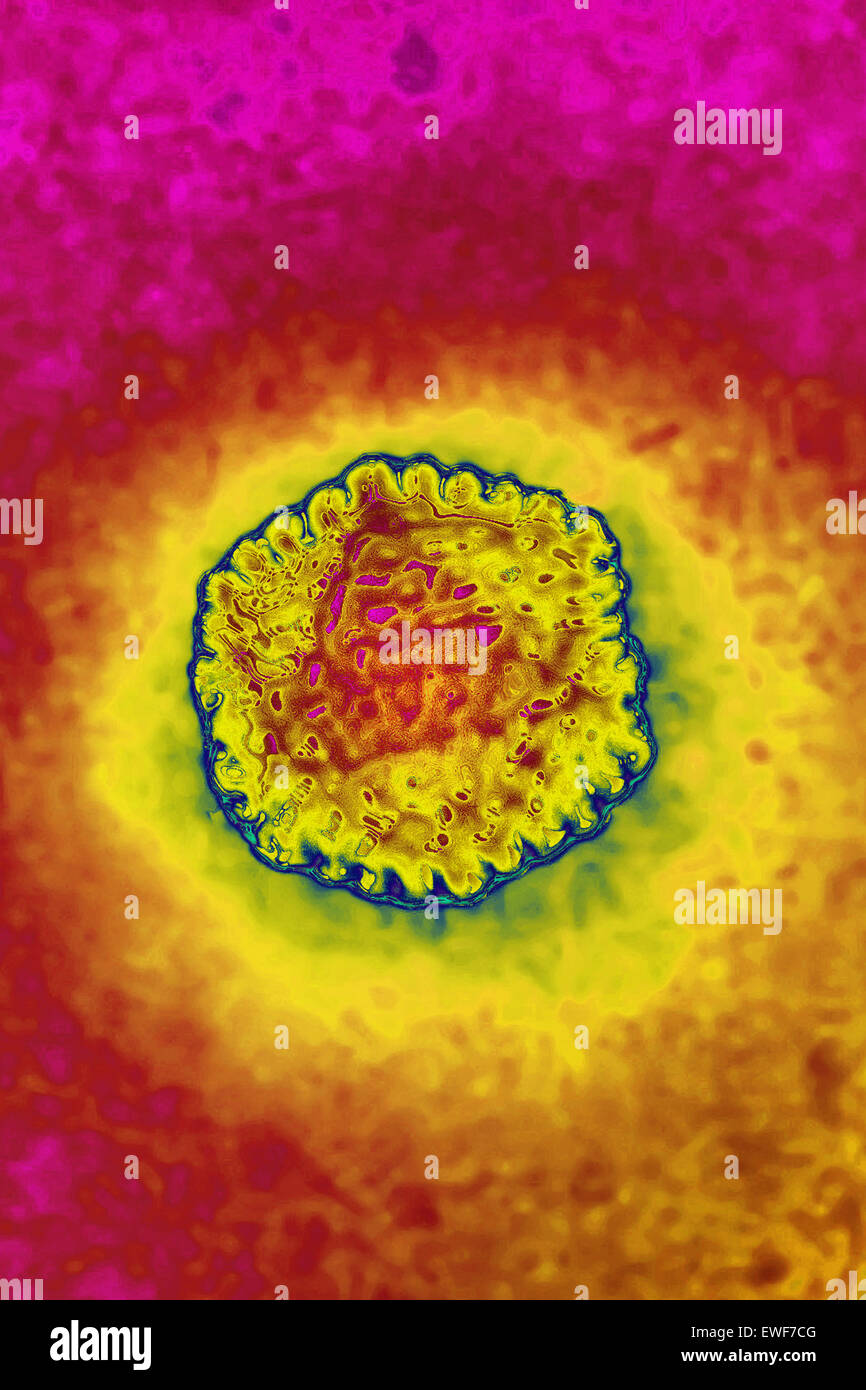 Hepatitis A Virus Under A Microscope More Than Third Of World's