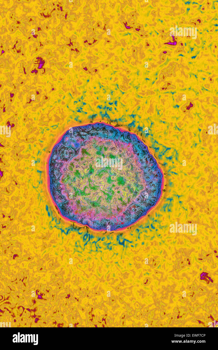Hepatitis c virus hi-res stock photography and images - Alamy