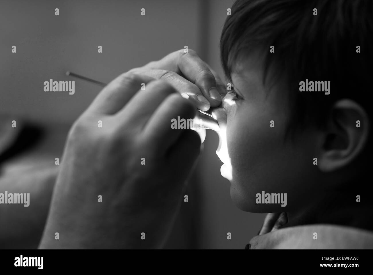 Ent examination Black and White Stock Photos & Images - Alamy