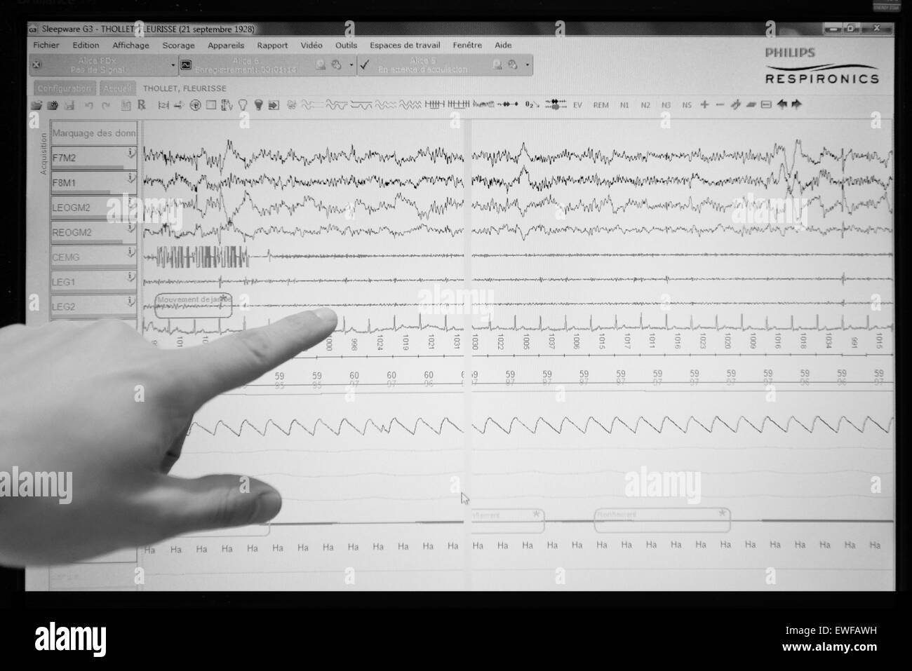 Polysomnogram hi-res stock photography and images - Alamy