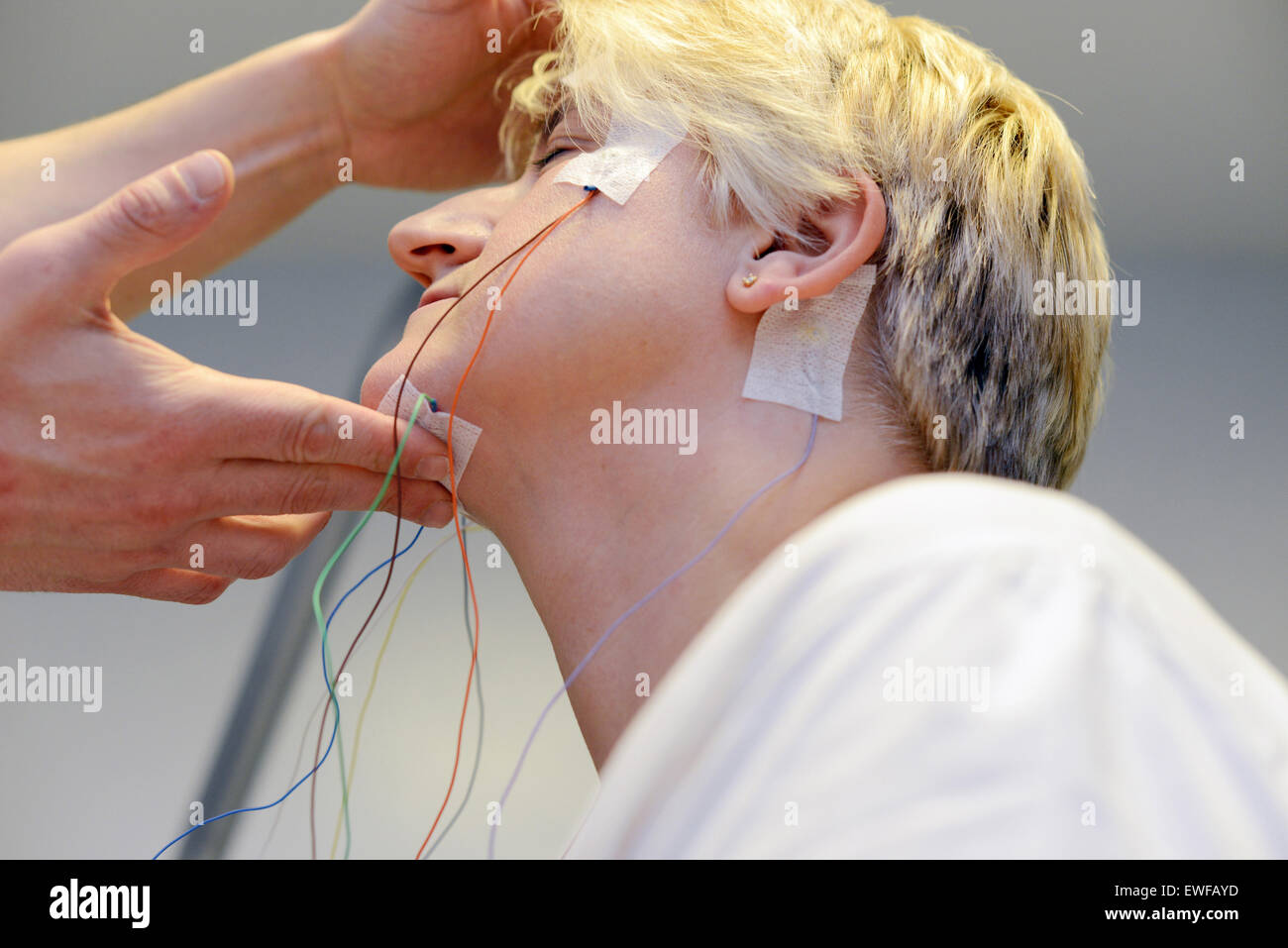 Cephalic disorder hi-res stock photography and images - Alamy