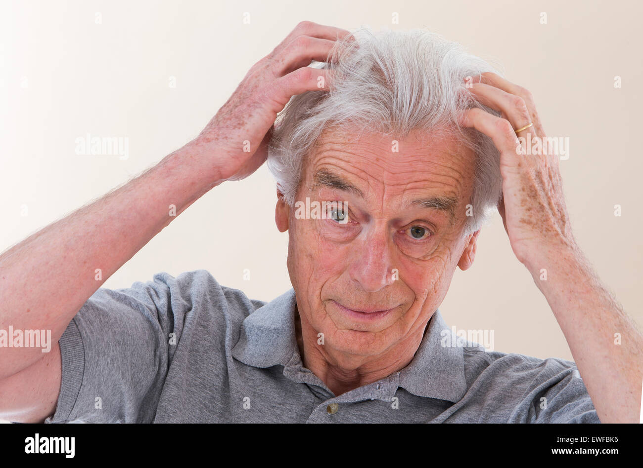 Man itching hair hi-res stock photography and images - Alamy