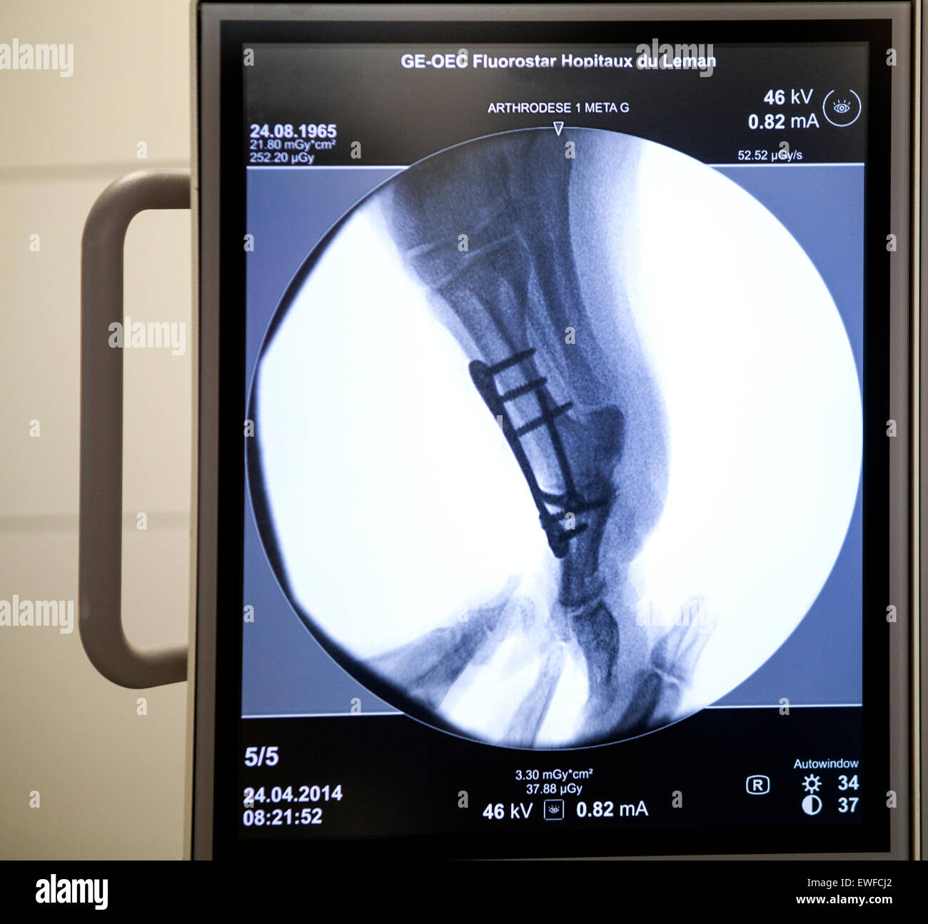 Orthopedic imaging hi-res stock photography and images - Alamy