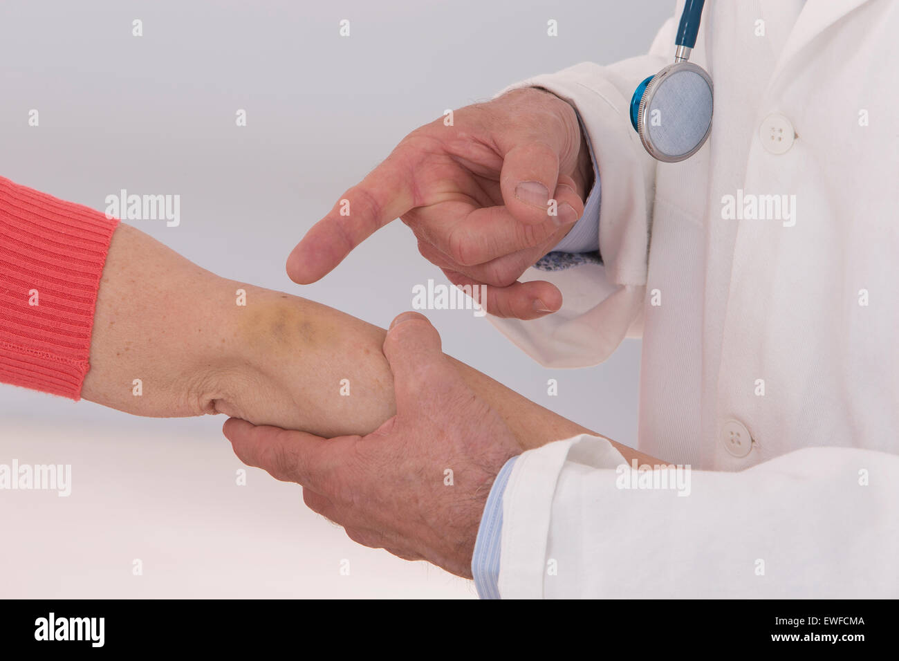 Hematoma arm hi-res stock photography and images - Alamy