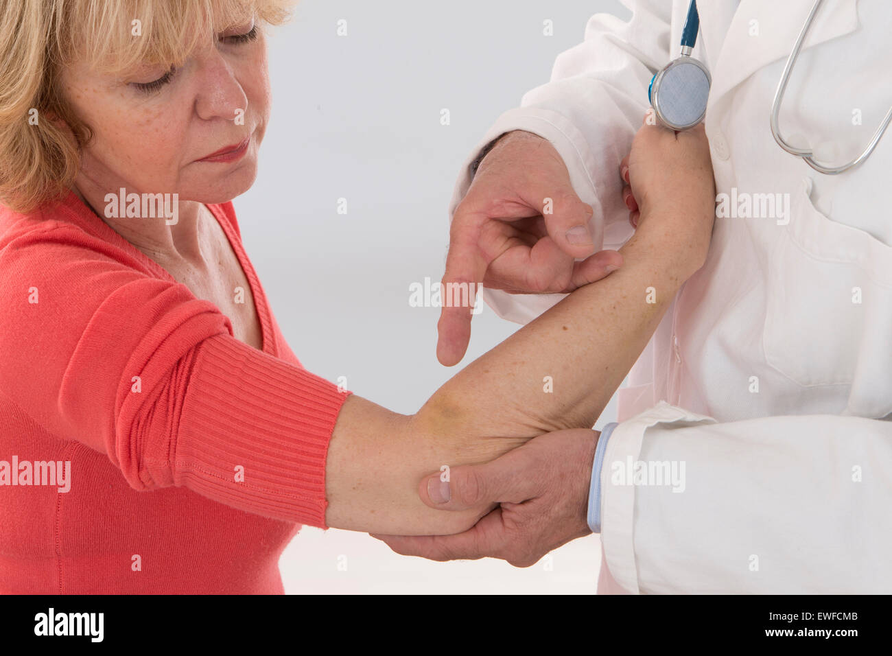 Hematoma arm hi-res stock photography and images - Alamy