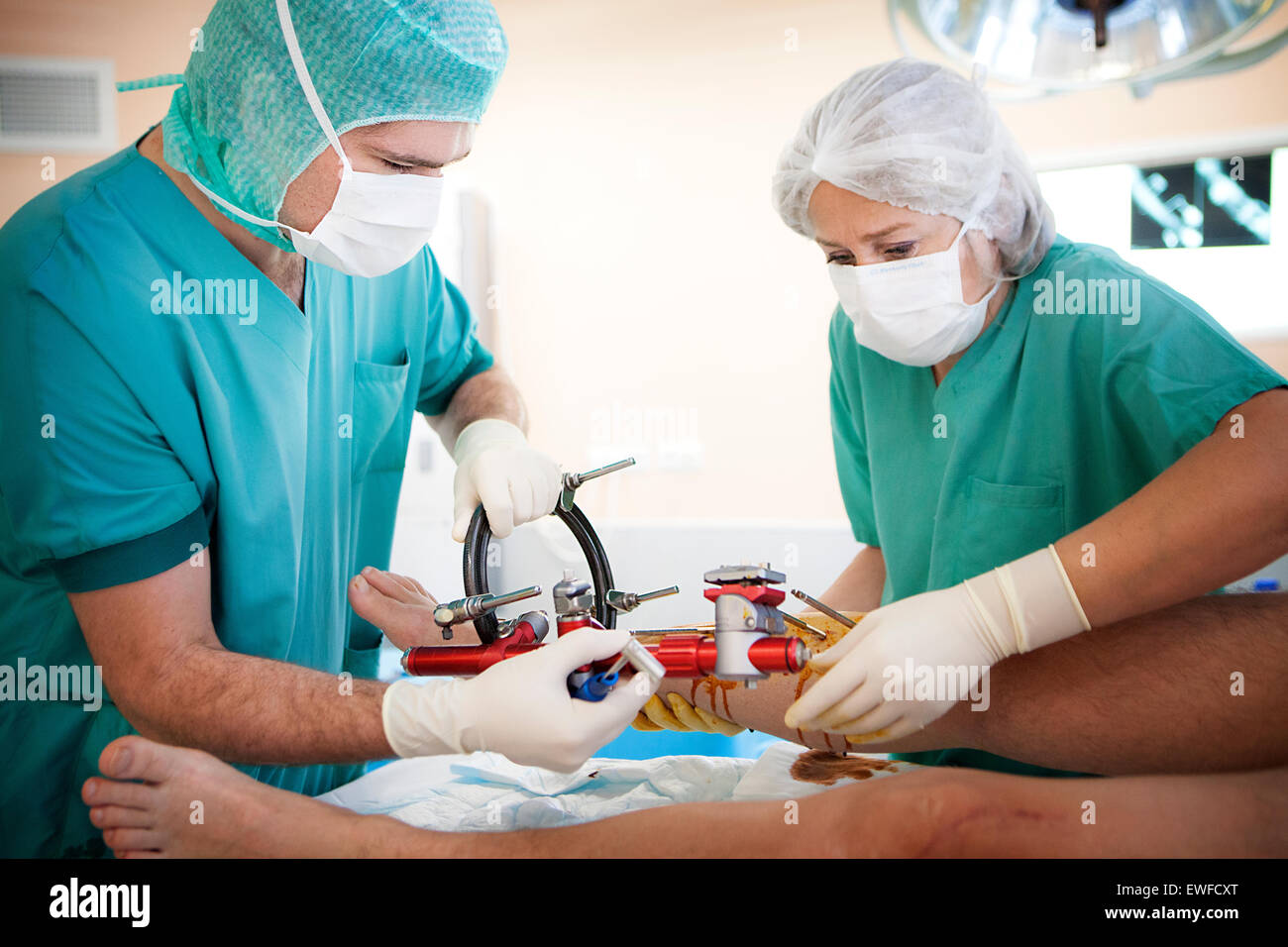 External fixation device hi-res stock photography and images - Alamy