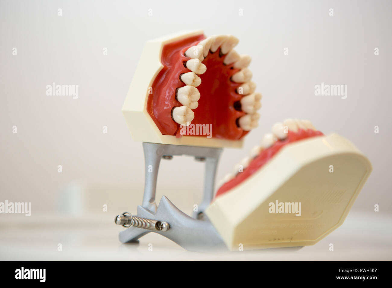 Berlin, Germany, a model set of teeth with periodontitis Stock Photo ...