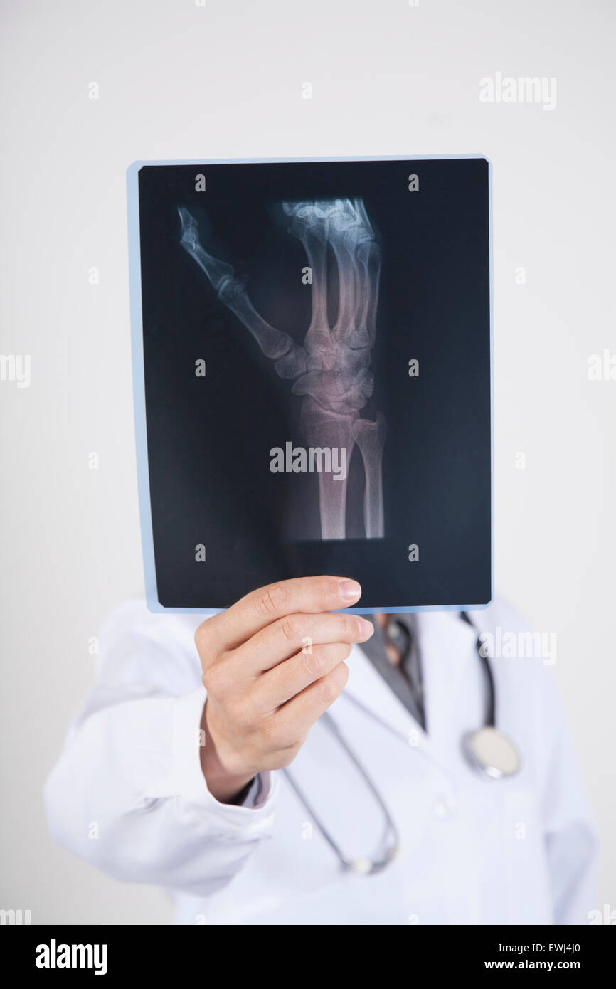 woman doctor with white gown and stethoscope with black radiography of ...