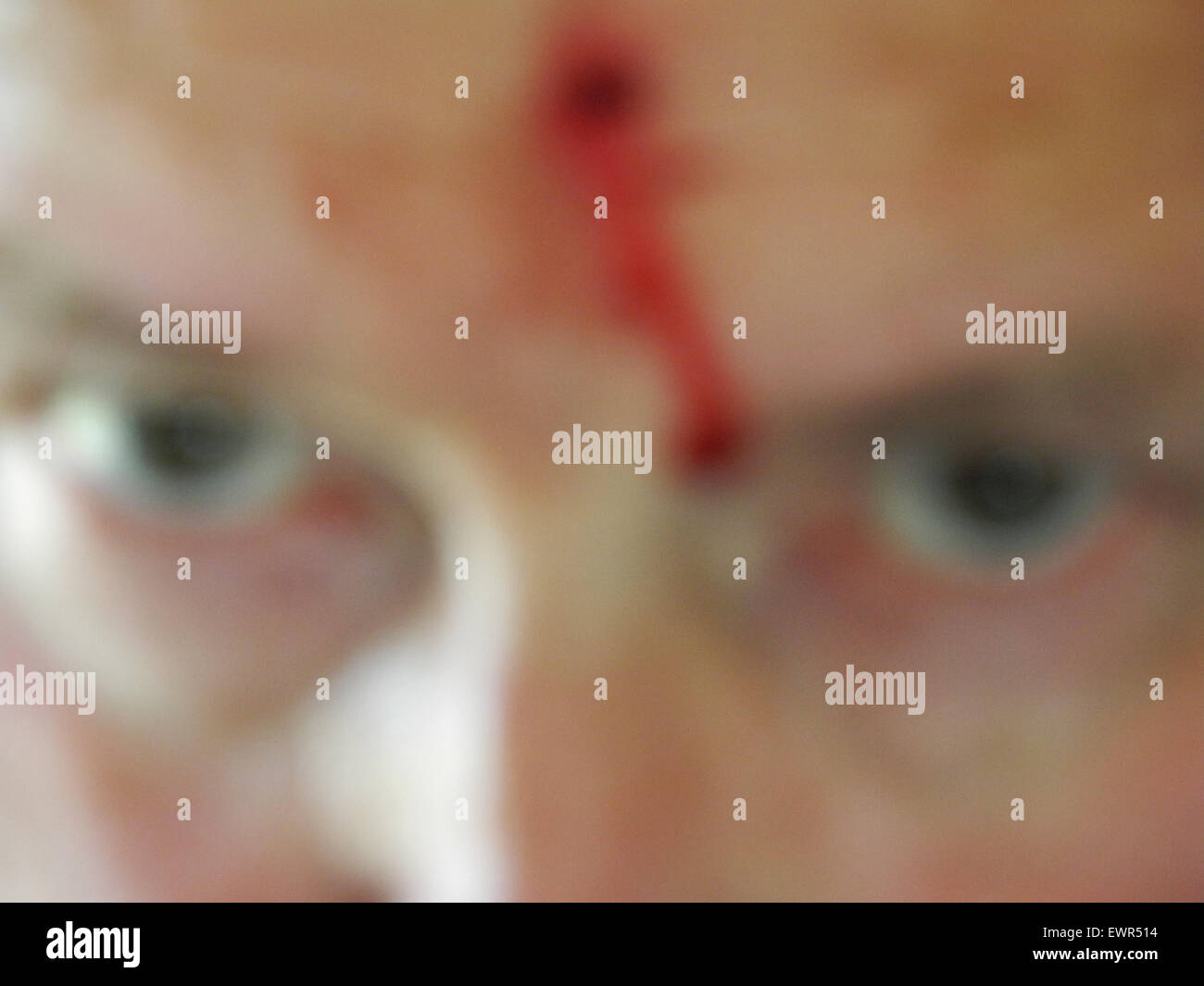 Shot bullet wound to head bleeding shooting injury firearm - MODEL ...