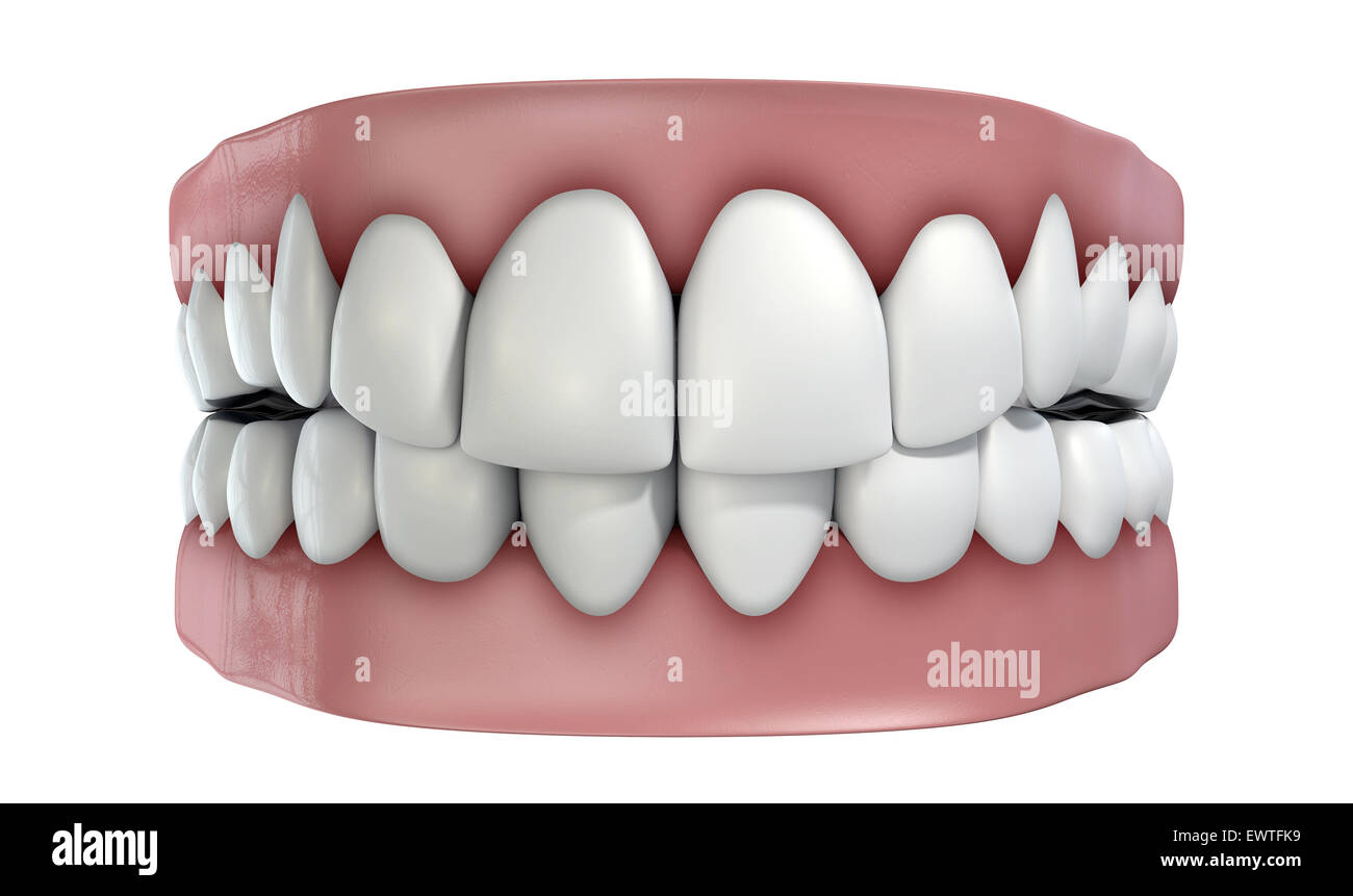 A set of false teeth on an isolated white studio background Stock Photo ...