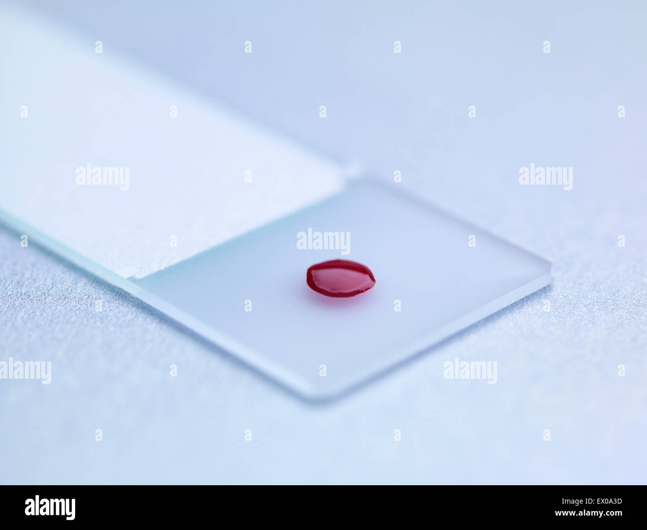 Blood sample on microscopic slide Stock Photo - Alamy