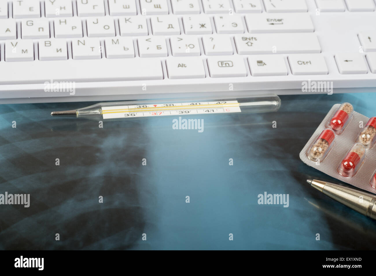 X-ray examination and keyboard Stock Photo - Alamy