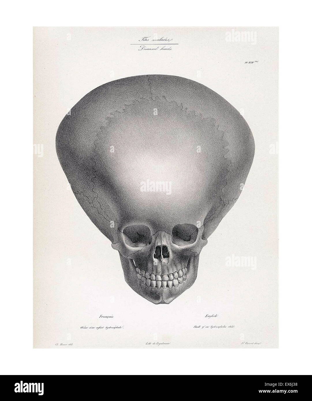 Franz joseph gall phrenology hi-res stock photography and images - Alamy