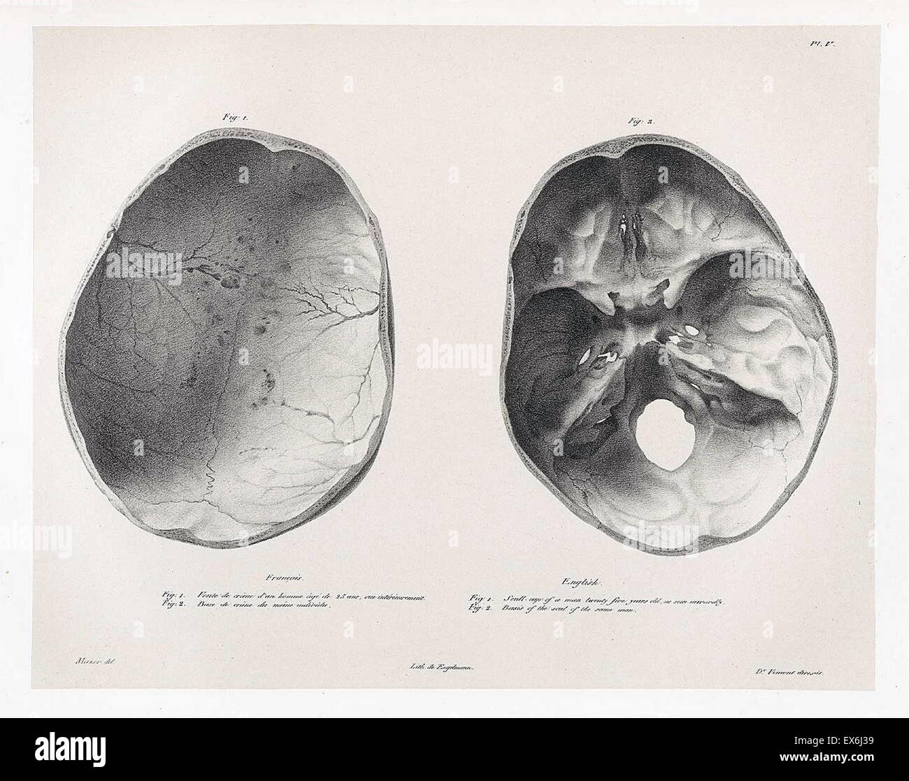 Franz joseph gall phrenology hi-res stock photography and images - Alamy
