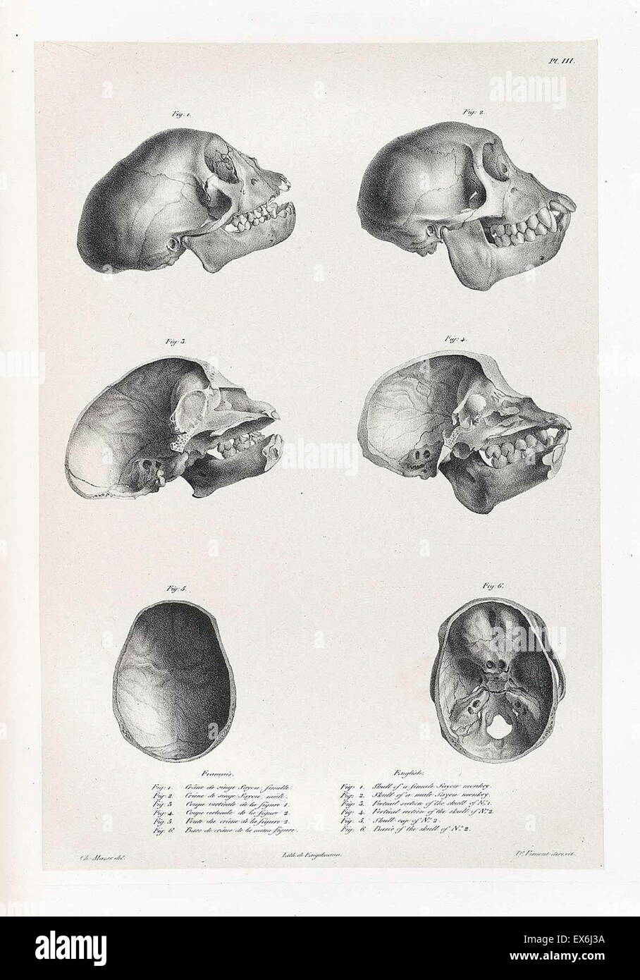 Franz joseph gall phrenology hi-res stock photography and images - Alamy