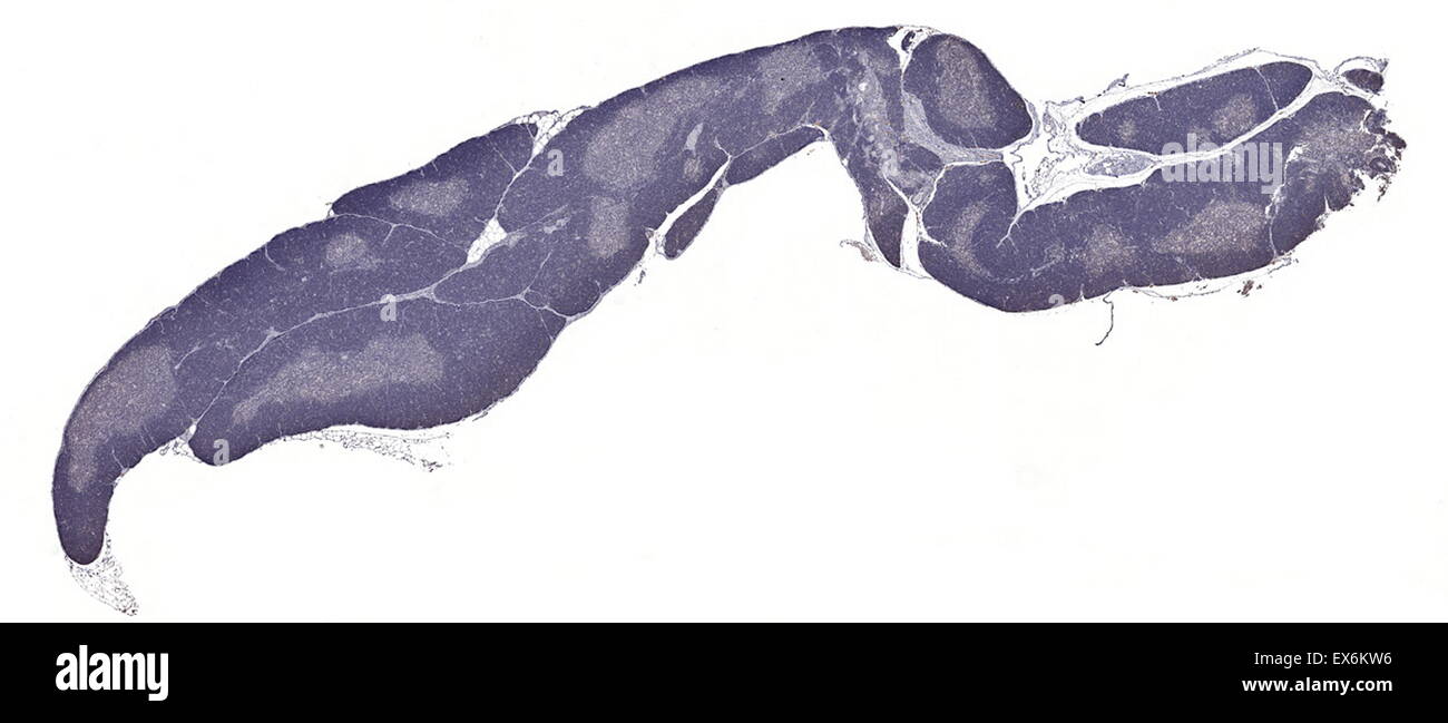 Histone H2B Ser14: Immunoperoxidase staining of formalin-fixed ...