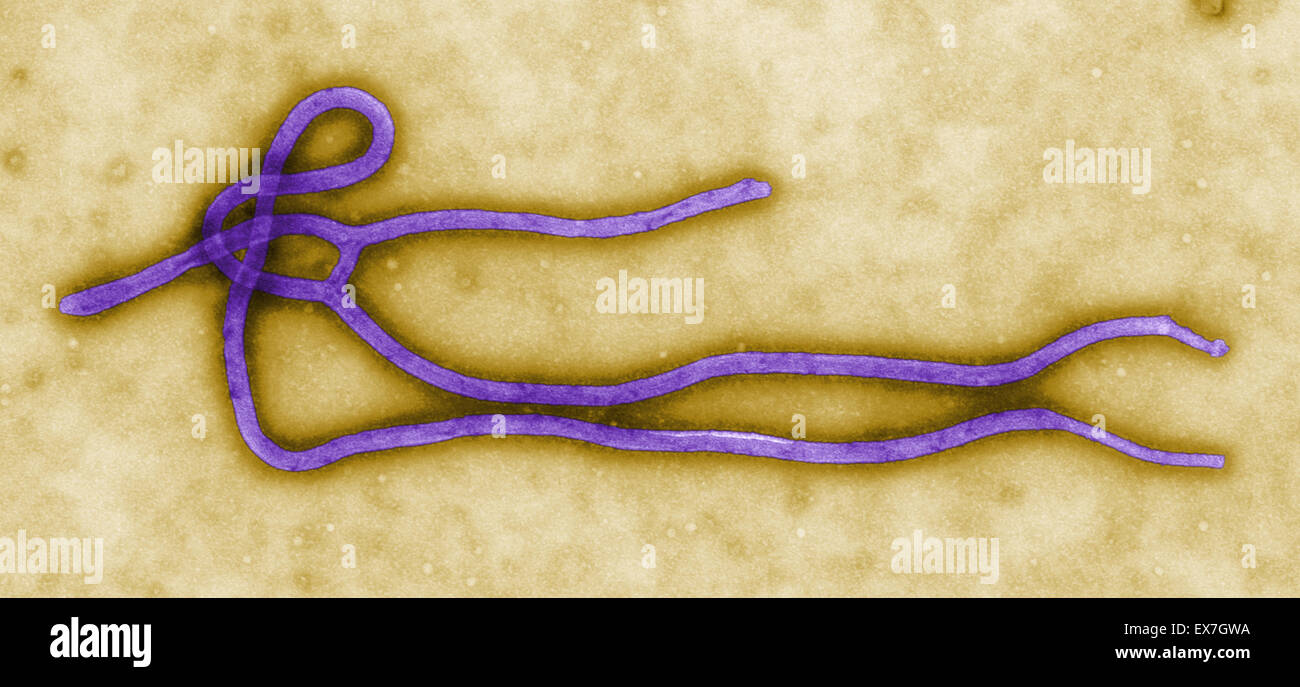 Transmission electron micrograph (TEM) of an Ebola virus virion Stock ...