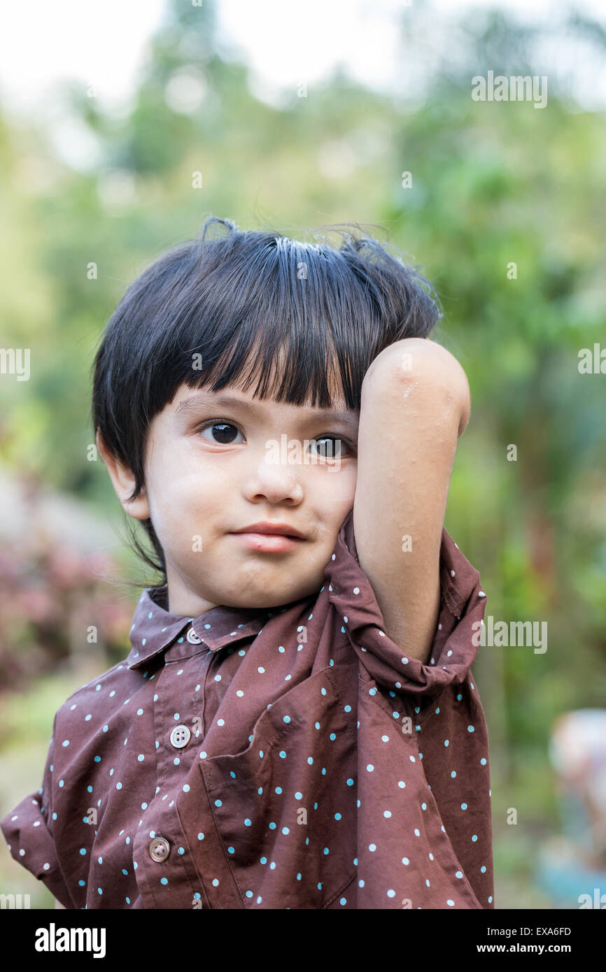 Portrait of Asian cute little boy itch allergy skin Stock Photo - Alamy