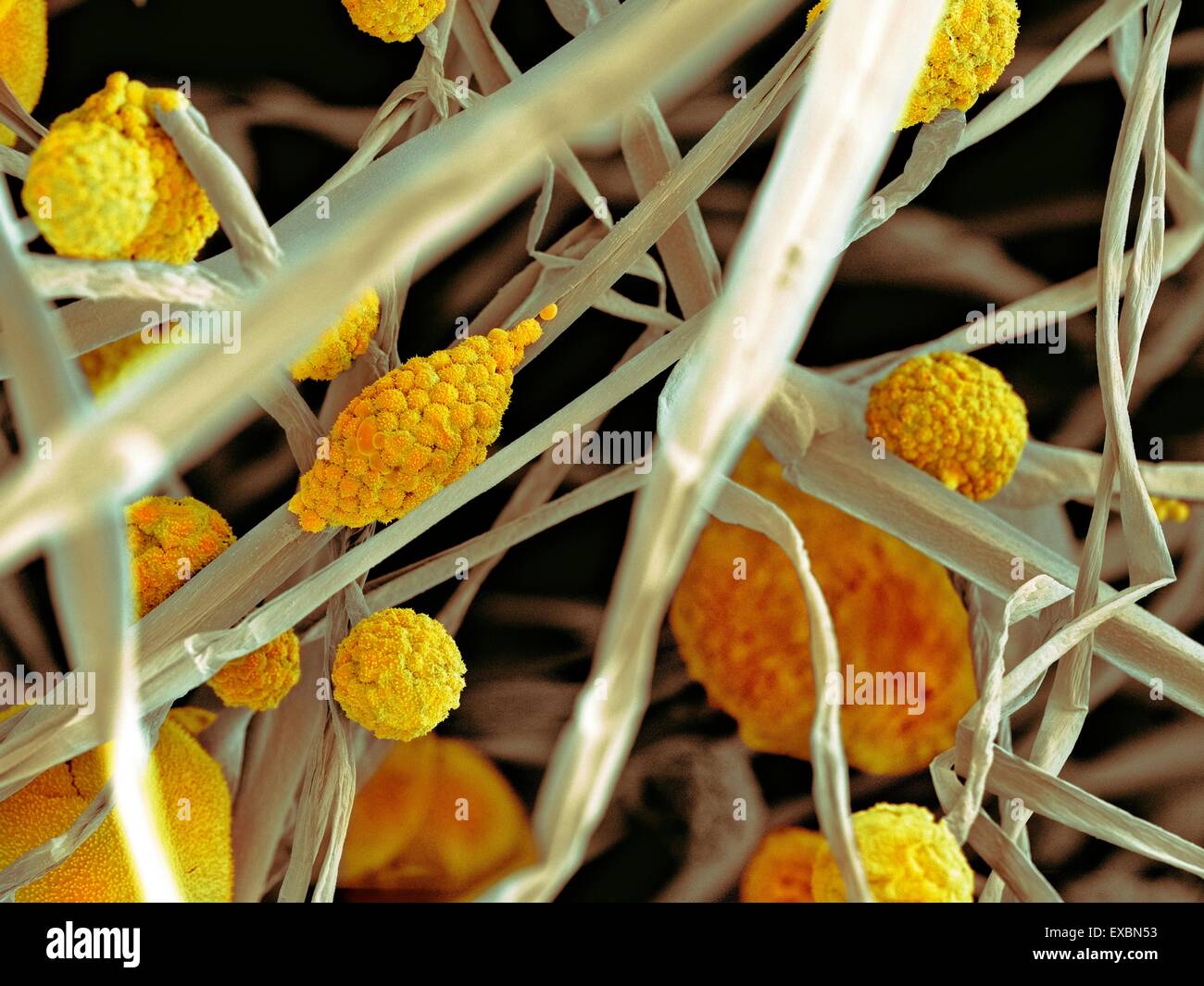 Coloured scanning electron micrograph (SEM) of fungal cells. The round ...