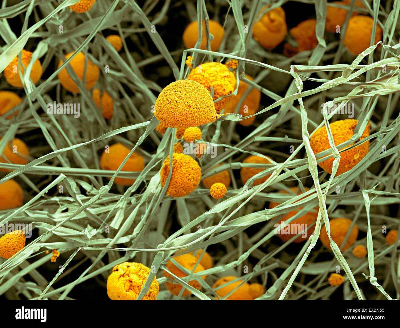 Coloured scanning electron micrograph (SEM) of fungal cells. The round ...