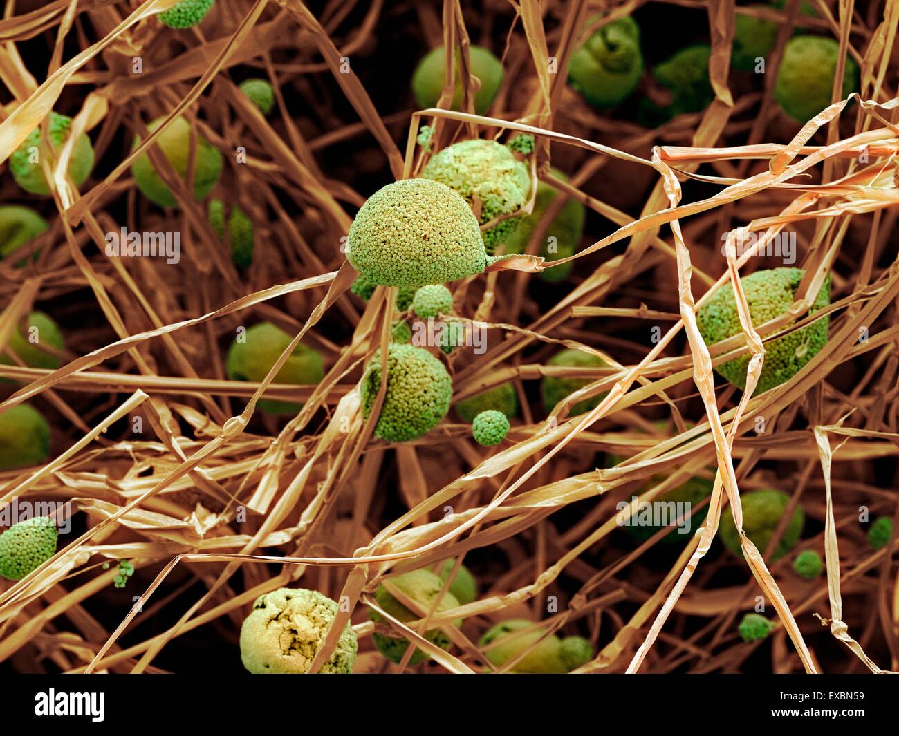Coloured scanning electron micrograph (SEM) of fungal cells. The Stock ...