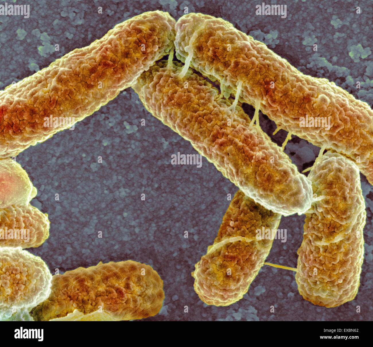 Coloured scanning electron micrograph (SEM) of Escherichia coli ...