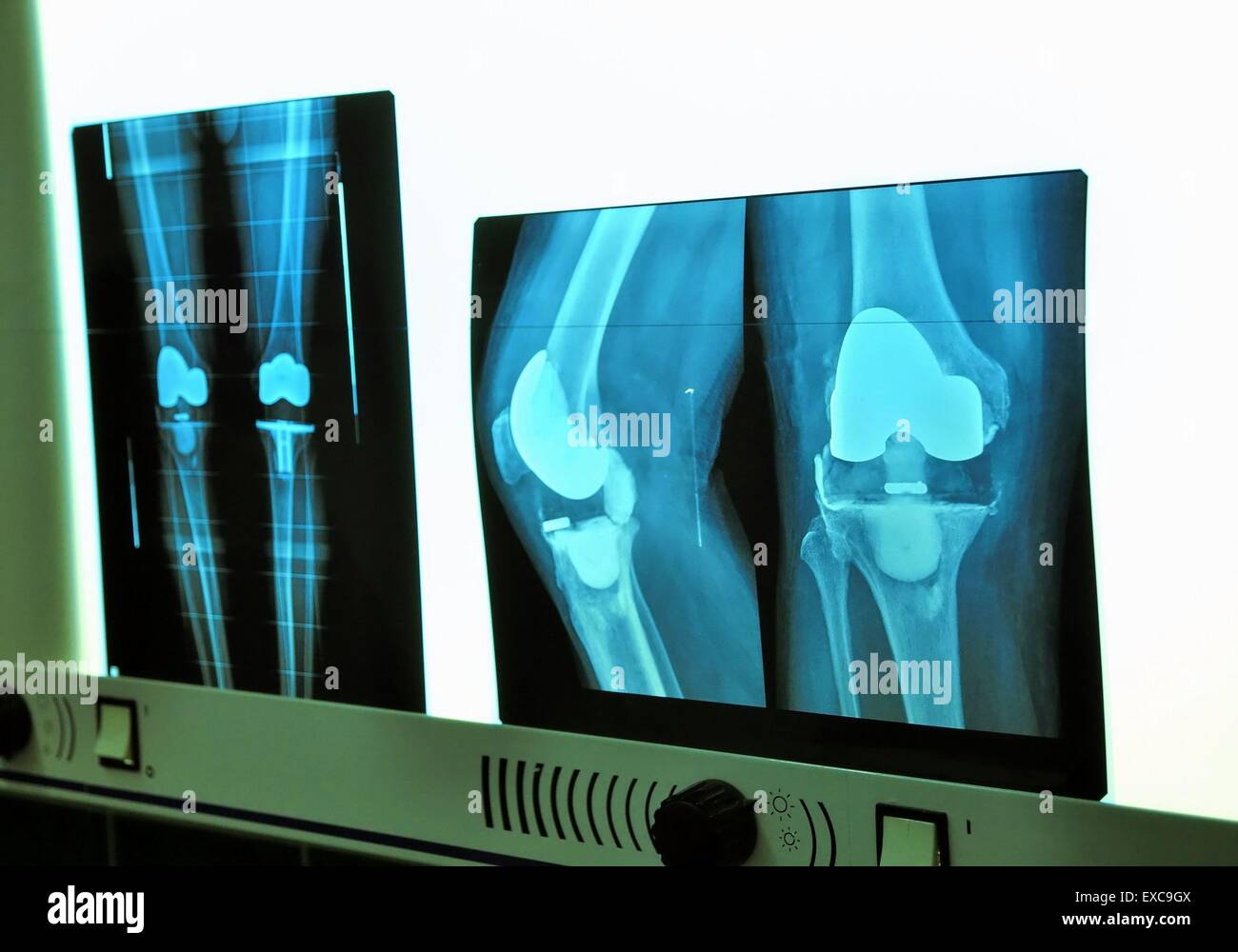 Human femur bone science photo hi-res stock photography and images - Alamy