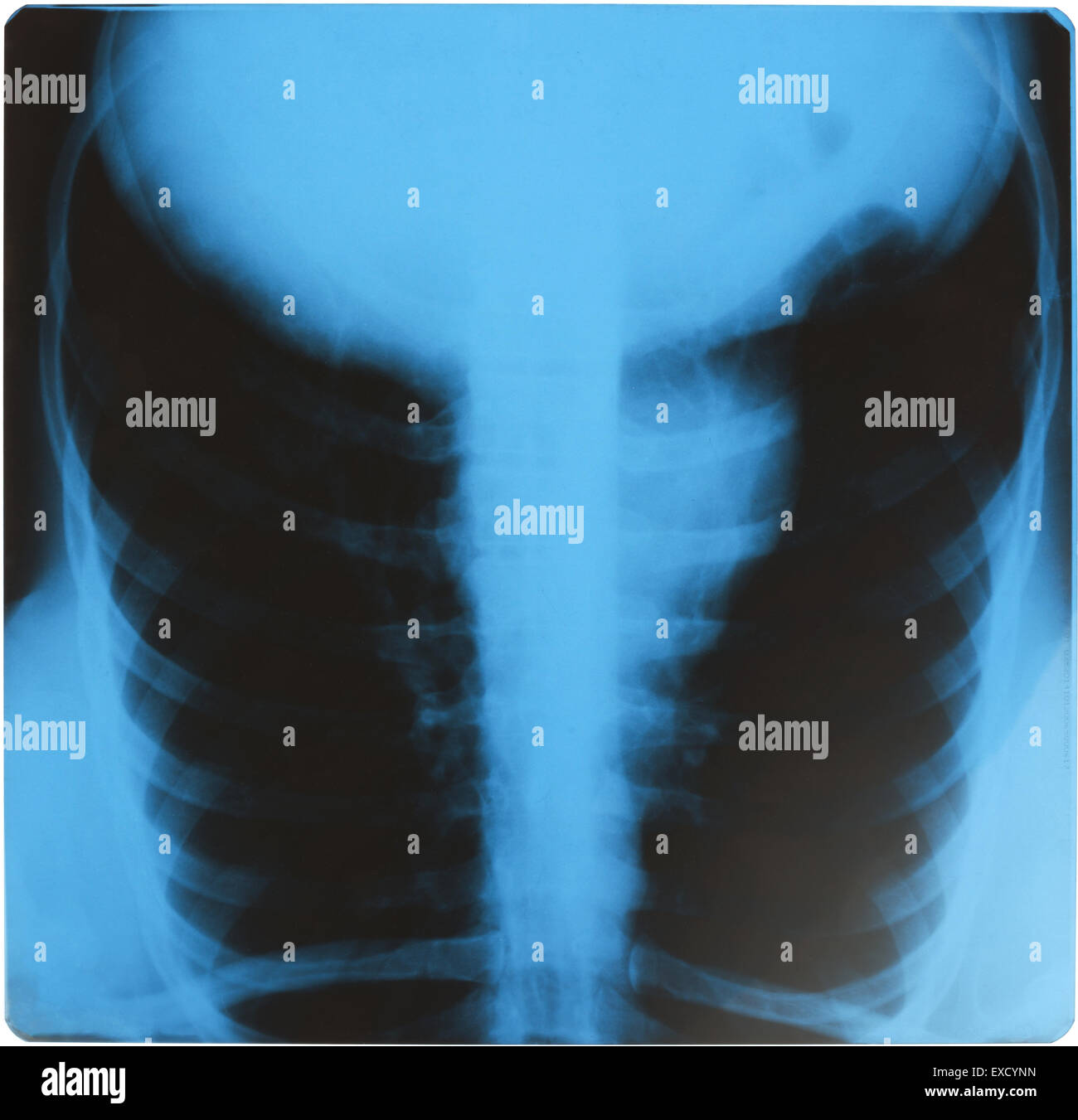 X-ray examination of human Stock Photo - Alamy