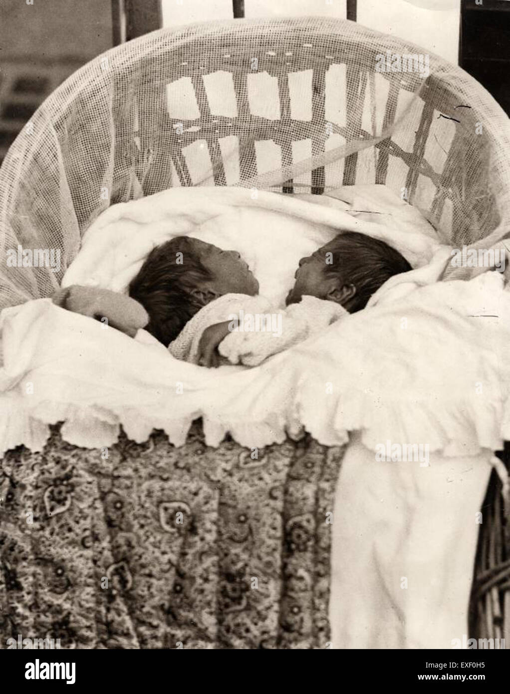 Vintage Siamese Twins High Resolution Stock Photography and Images - Alamy
