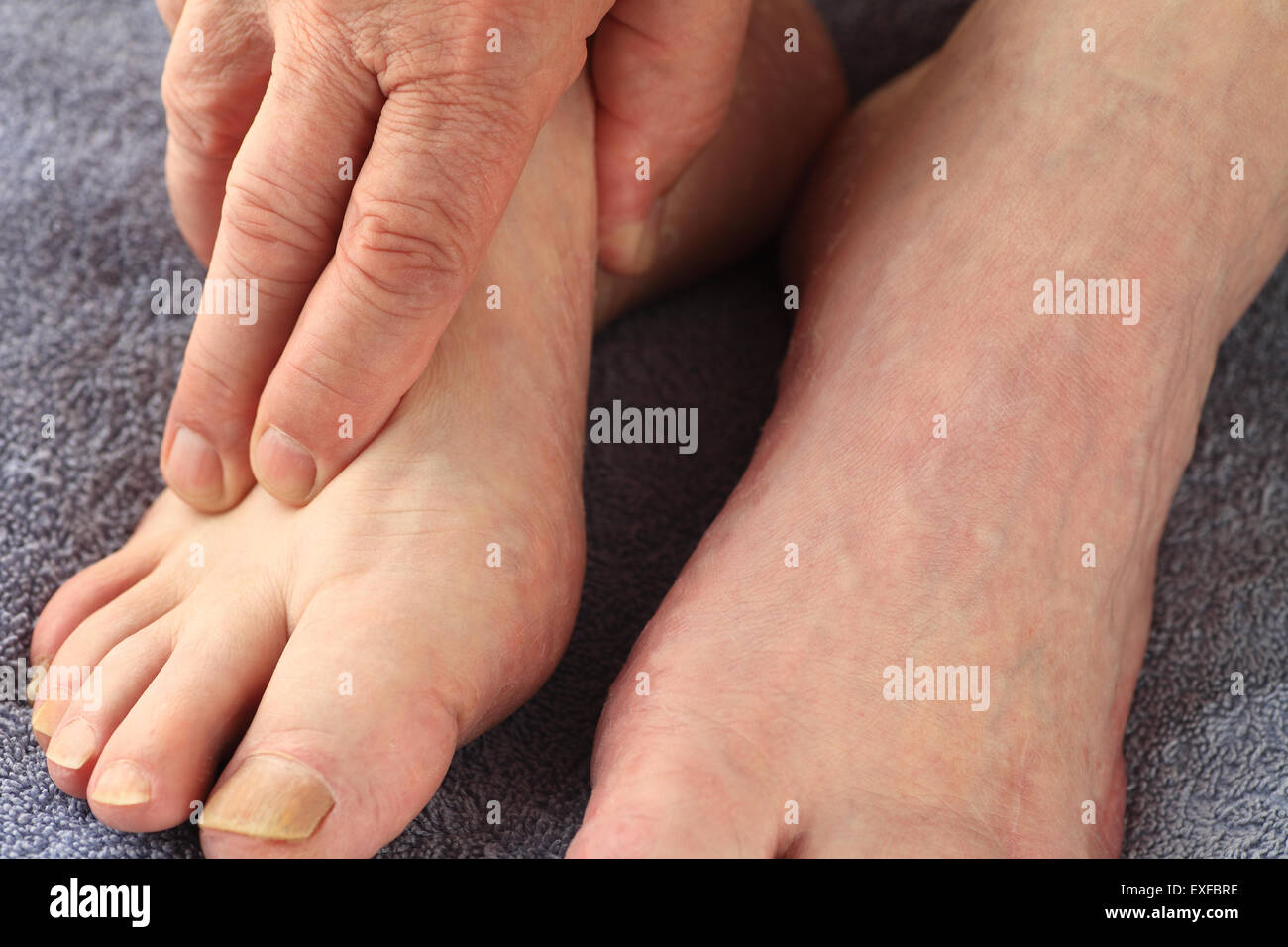 Fingers and toes hi-res stock photography and images - Alamy