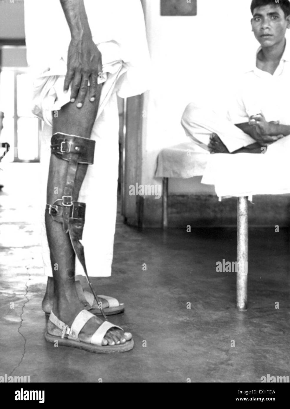 This photograph shows a leper patient in Shantipur, India, receiving ...