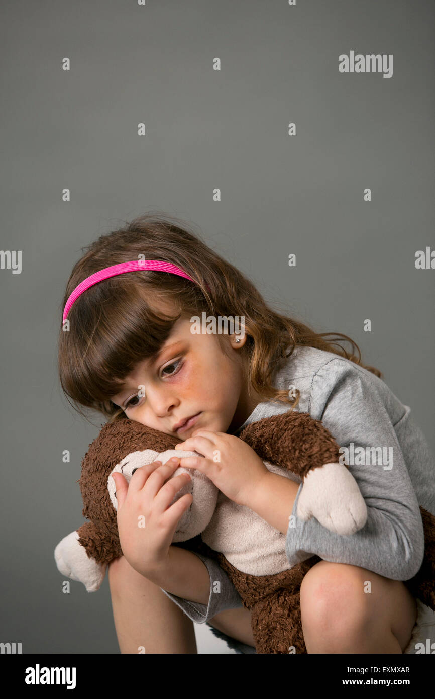 Portrait of young girl with a bruise or black eye on her left side ...