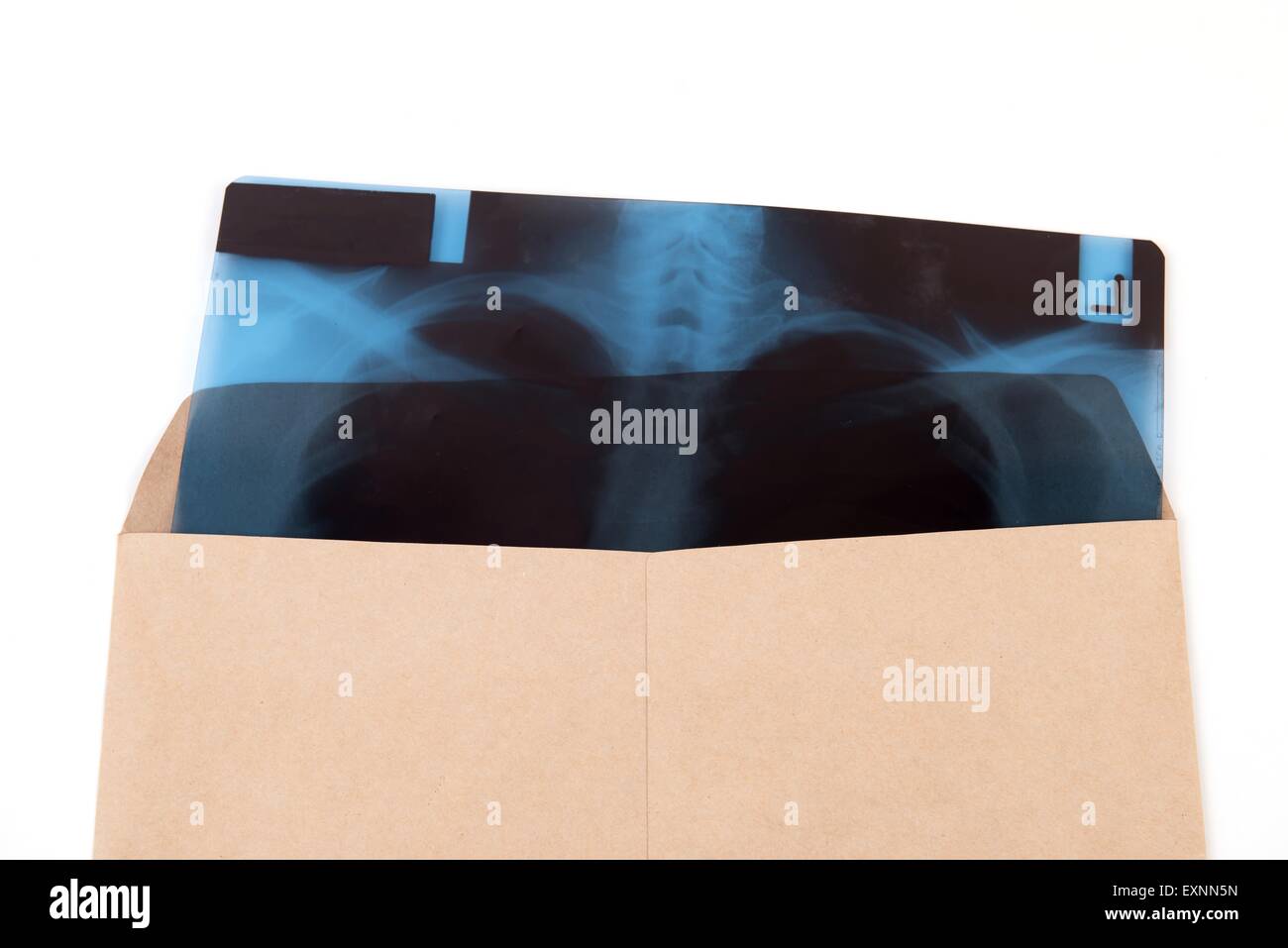 x-ray film of chest in brown envelope isolated on white background ...