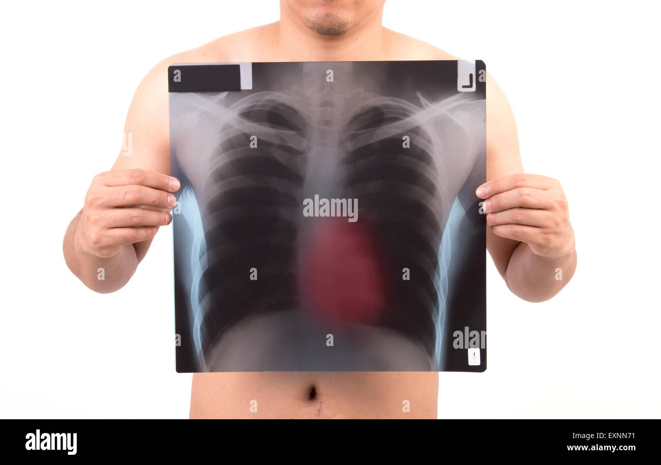 Chest anatomy hi-res stock photography and images - Alamy
