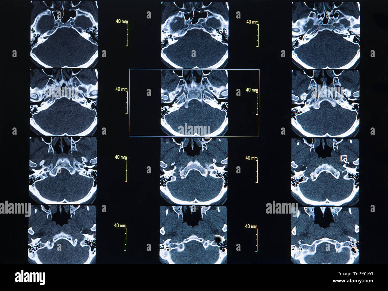 Ct scan abdomen hi-res stock photography and images - Alamy