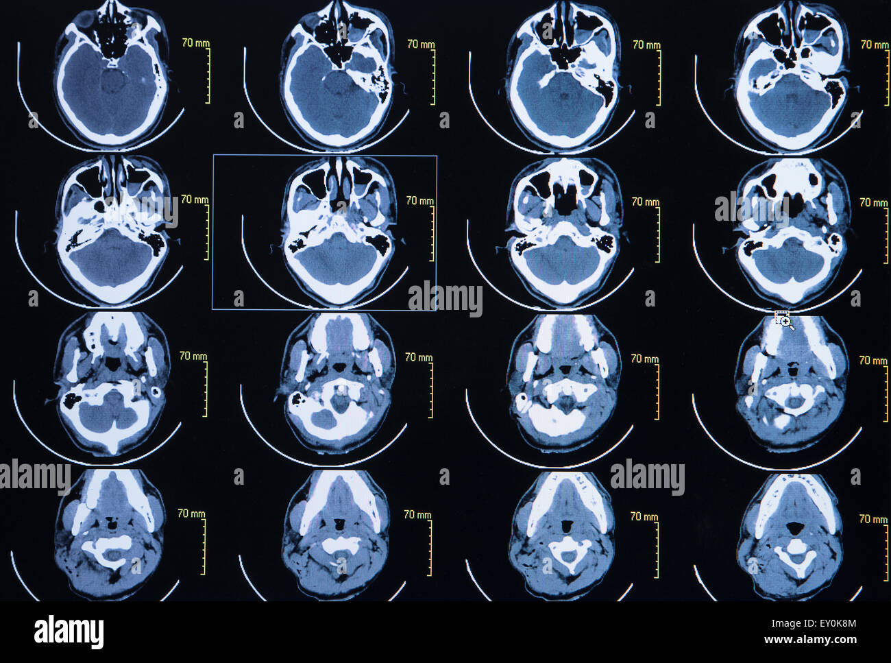 Series of images from a computerized tomography of the brain Stock ...