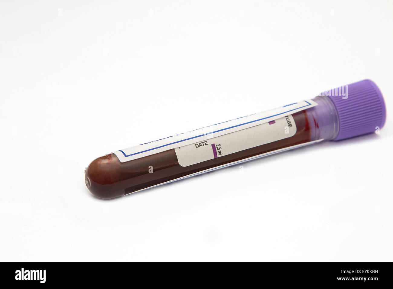 Blood sample for analysis in the laboratory Stock Photo - Alamy