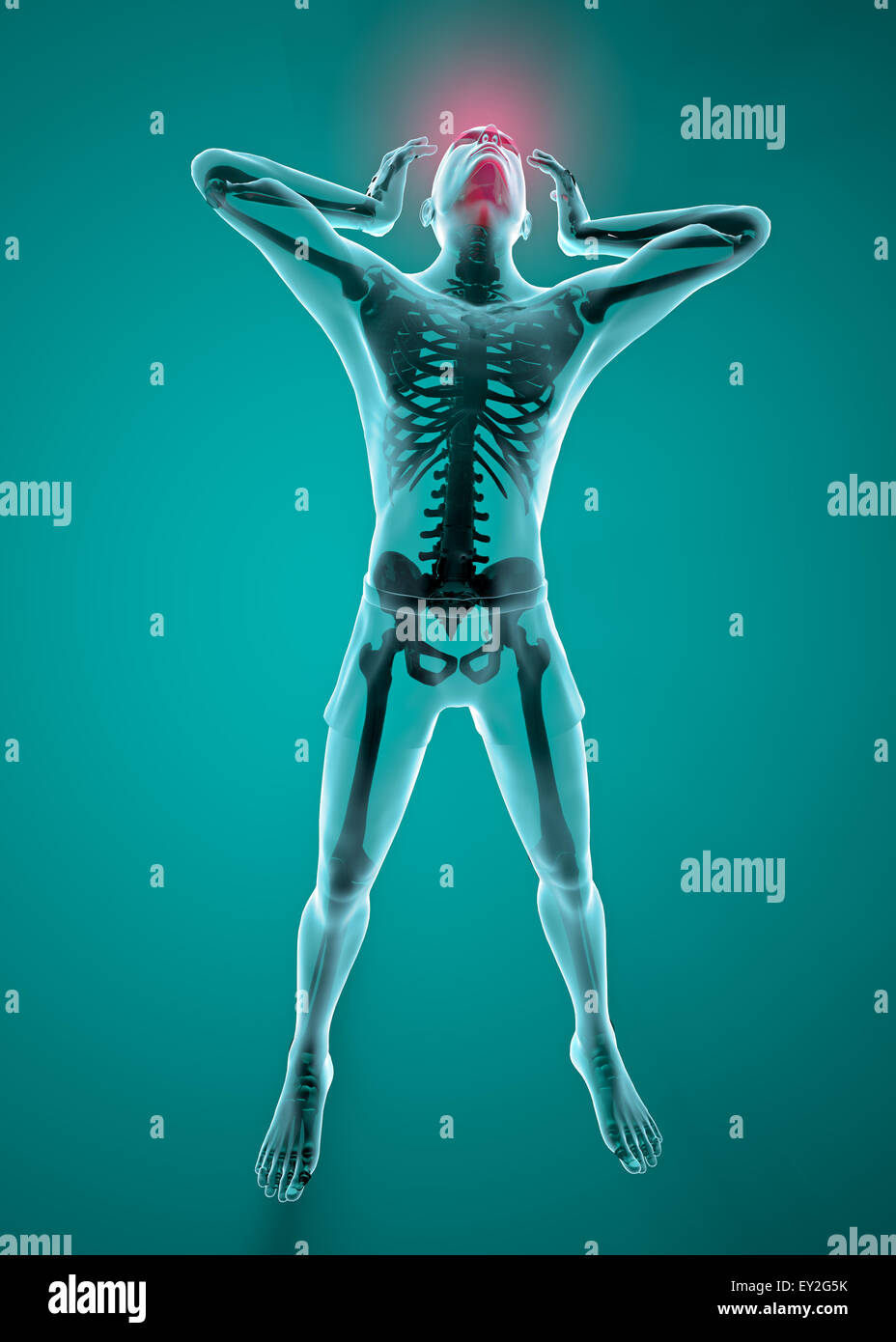 X ray man neck hi-res stock photography and images - Alamy