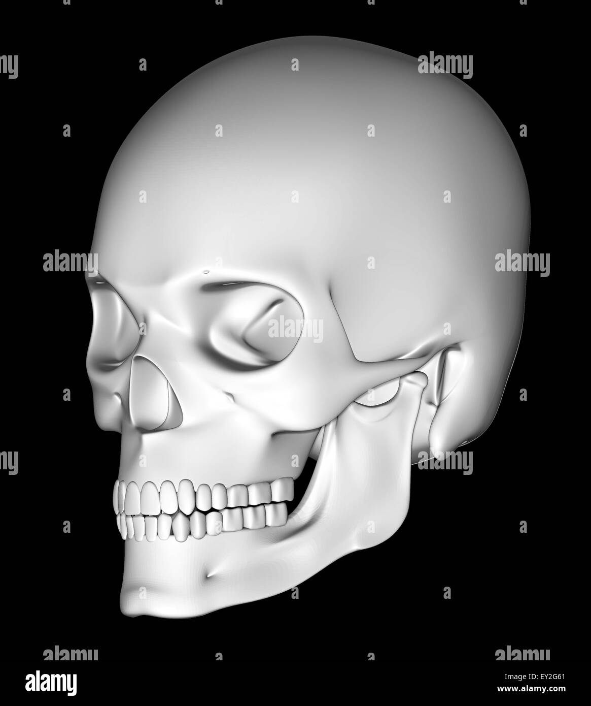 Skull surgery hi-res stock photography and images - Alamy
