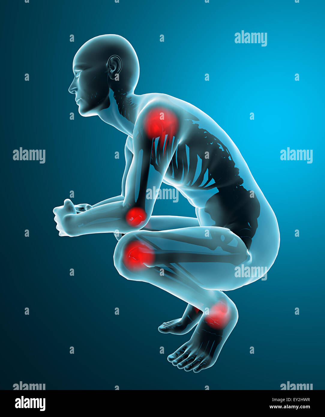 Joint pain hi-res stock photography and images - Alamy