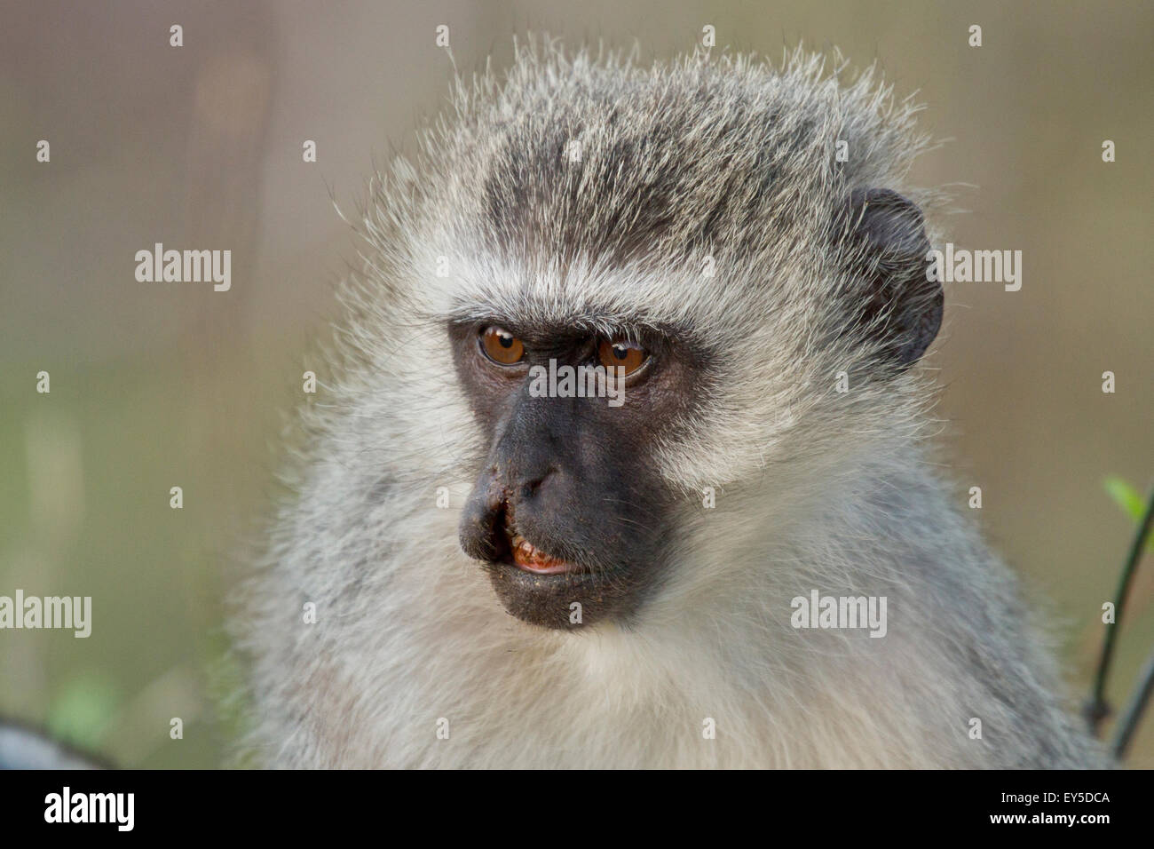 Cleft palate hi-res stock photography and images - Alamy