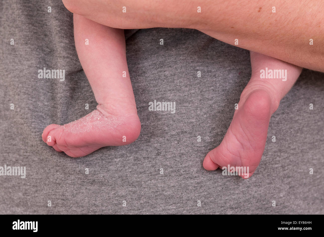 Newborn baby feet toes close hi-res stock photography and images - Alamy