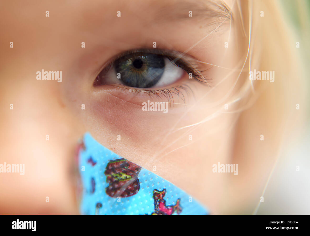 Plaster child girl injury plaster hi-res stock photography and images ...