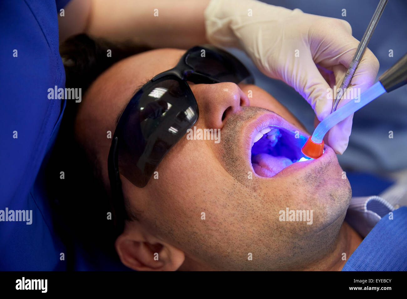 close up of male patient with dental curing light Stock Photo - Alamy
